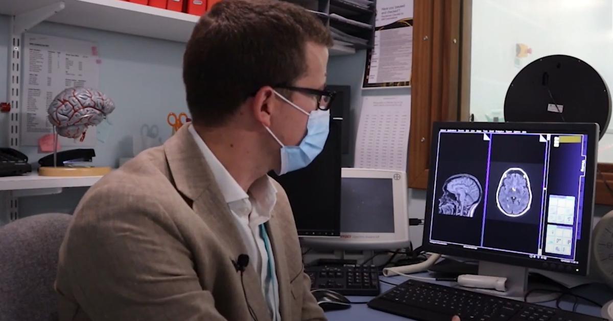 Ask the expert: MRI scans | MS Trust